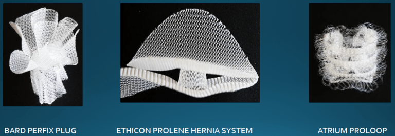 Hernia Mesh Defects: Why Inguinal Plugs and Ventral Patches Can Be ...